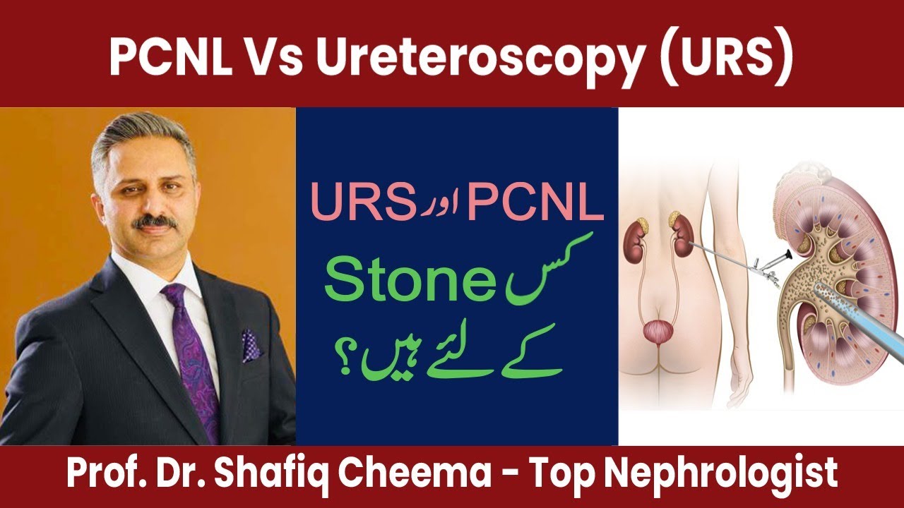 PCNL or Ureteroscopy for Kidney Stones ? - YouTube