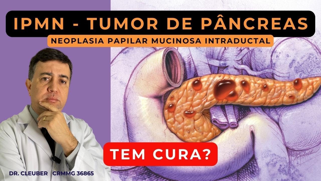 IPMN - TUMOR DE PÂNCREAS - Diagnóstico e Cura 🦠 - YouTube