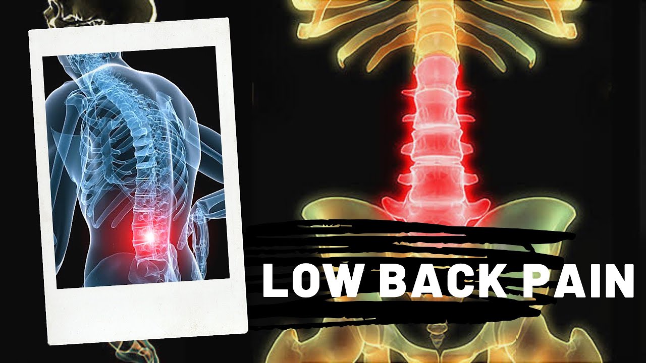 Low Back Pain (LBP) - YouTube