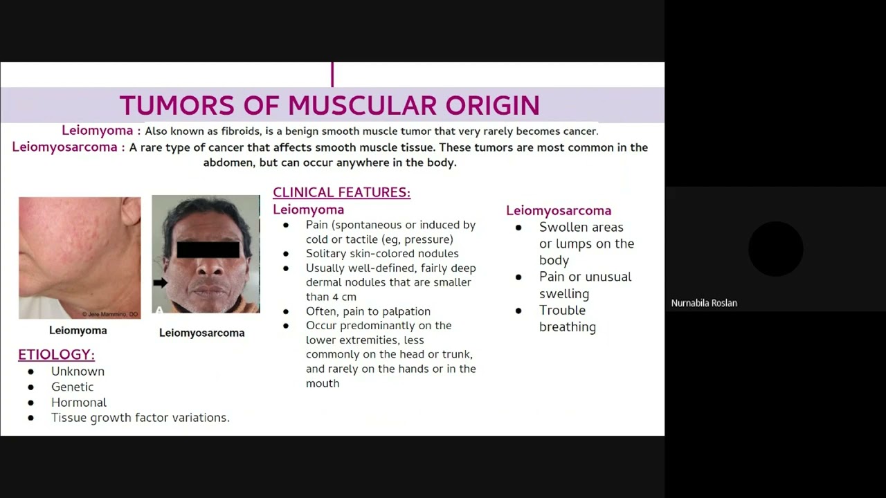 One Side of Your Face Swollen? Unilateral Facial Swelling Causes ...