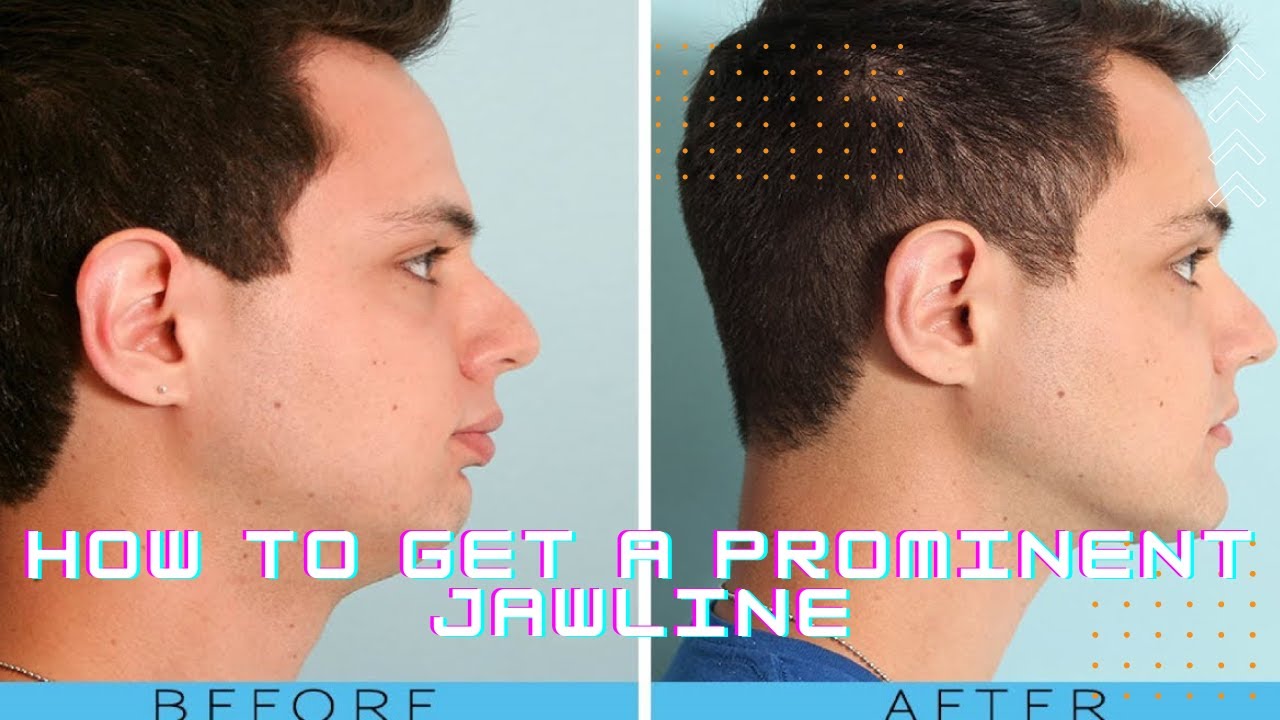 How To Change Face Structure ep 3 - YouTube