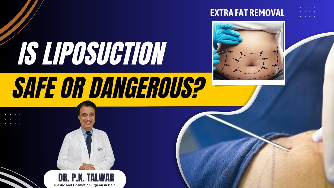 Is Liposuction Safe or Dangerous? Extra Fat Removal Surgery | Dr. PK ...