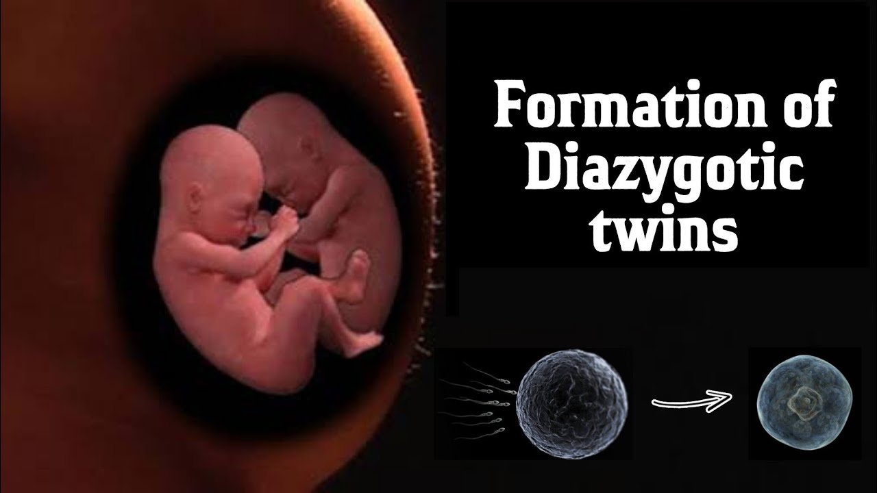 Video On How Twins Are Formed at Sammy Parra blog