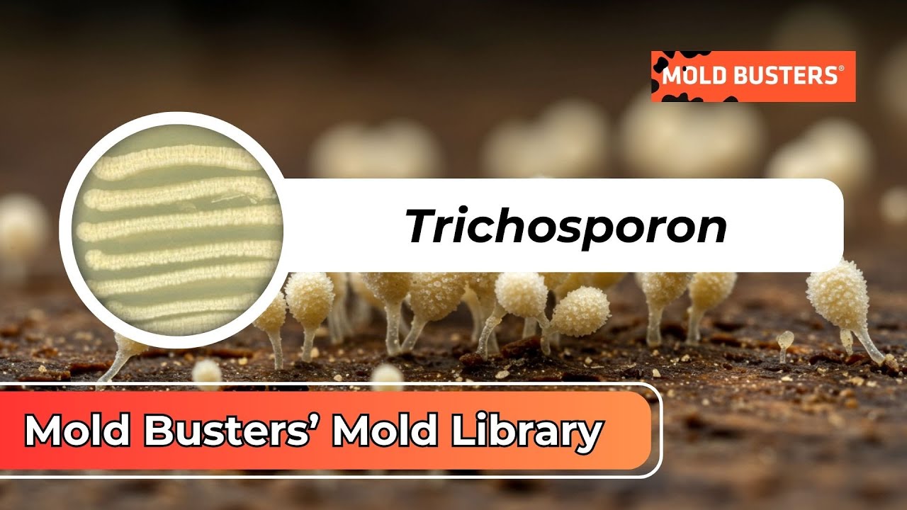 Trichosporon: The Yeast-Like Fungus Hiding in Your Home! 🏡🦠 - YouTube