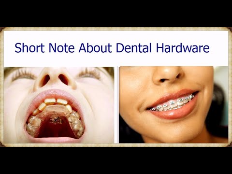 A Visual Guide to Dental Hardware - YouTube