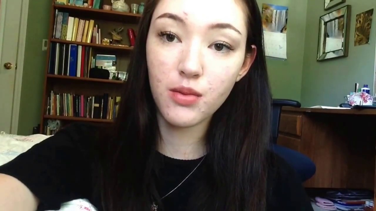 ACCUTANE END OF MONTH 1 PROGRESS YouTube ACCUTANE END OF MONTH 1 PROGRESS YouTube