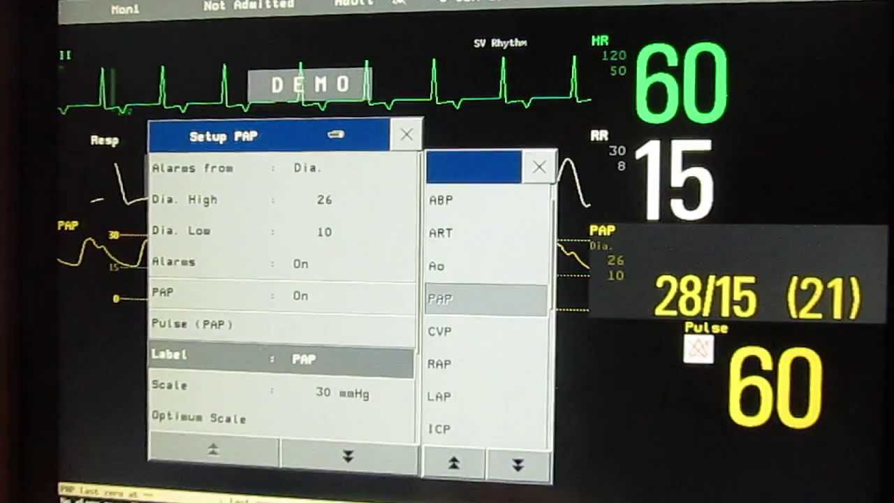 Philips MP70 IBP labels - YouTube