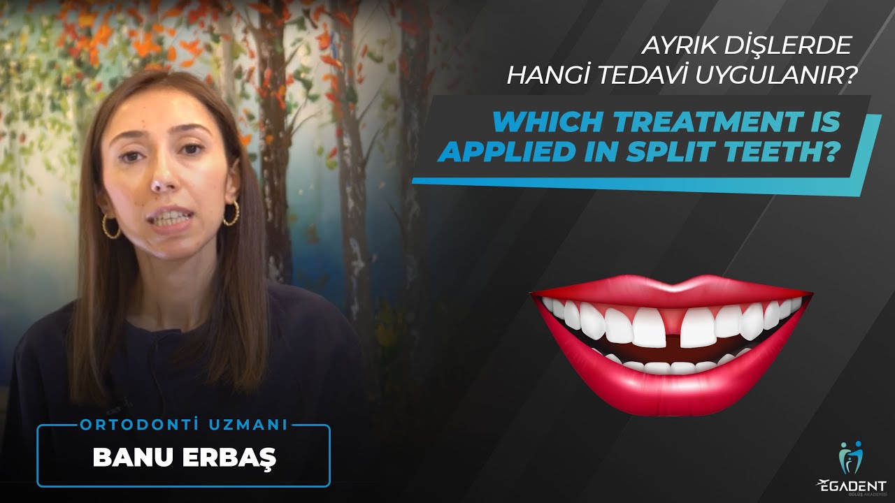 Which treatment is applied in split teeth? - Ayrık dişlerde hangi ...