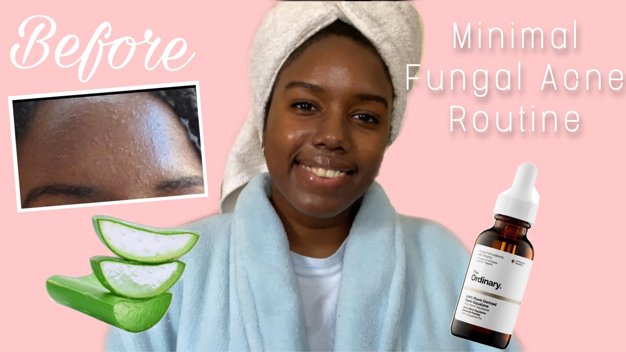 MY FUNGAL ACNE ROUTINE| Minimal | Natural - YouTube