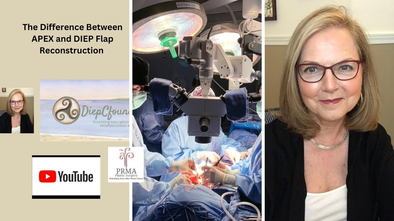 The Difference Between APEX and DIEP Flap Reconstruction - YouTube