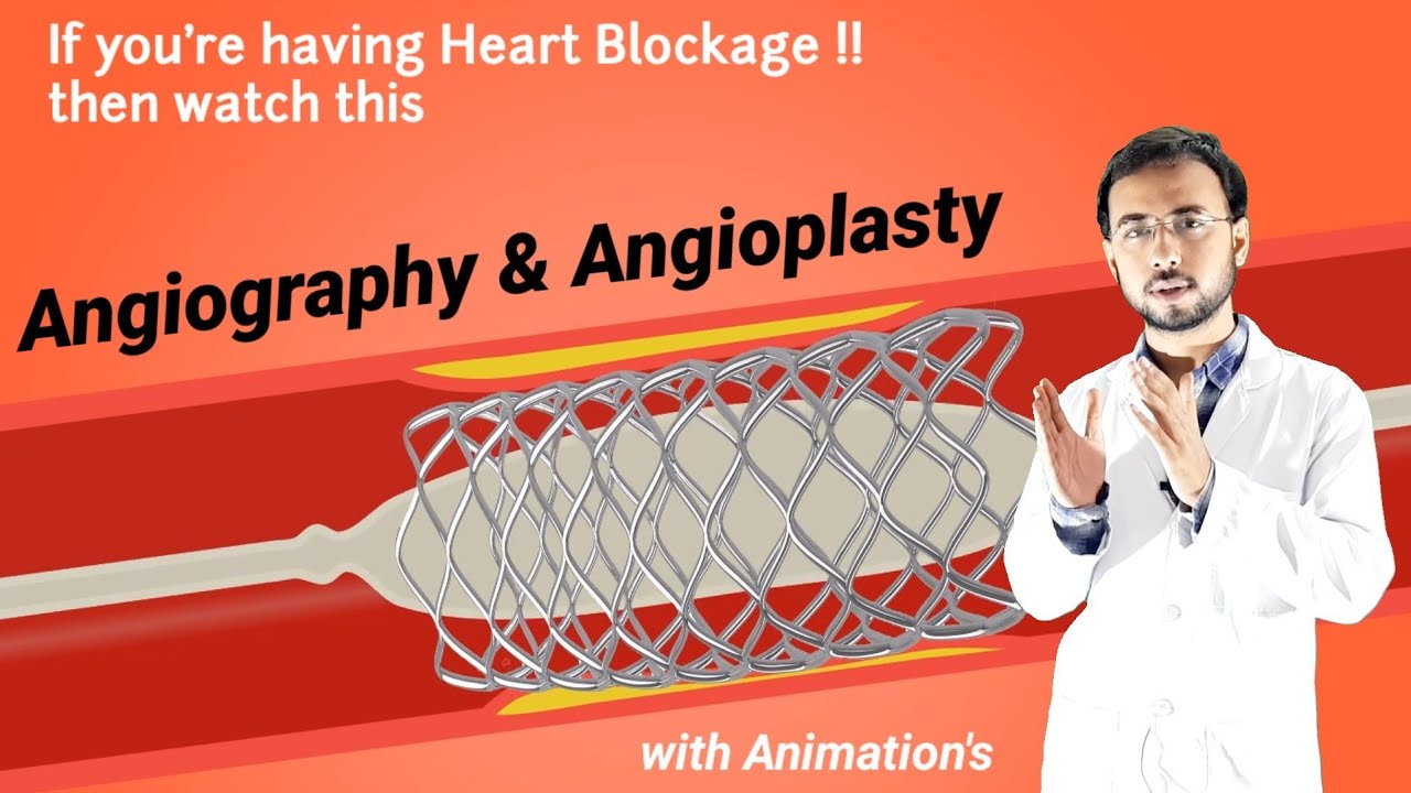 Angiography & Angioplasty procedure animation | Angiography kaise hota ...