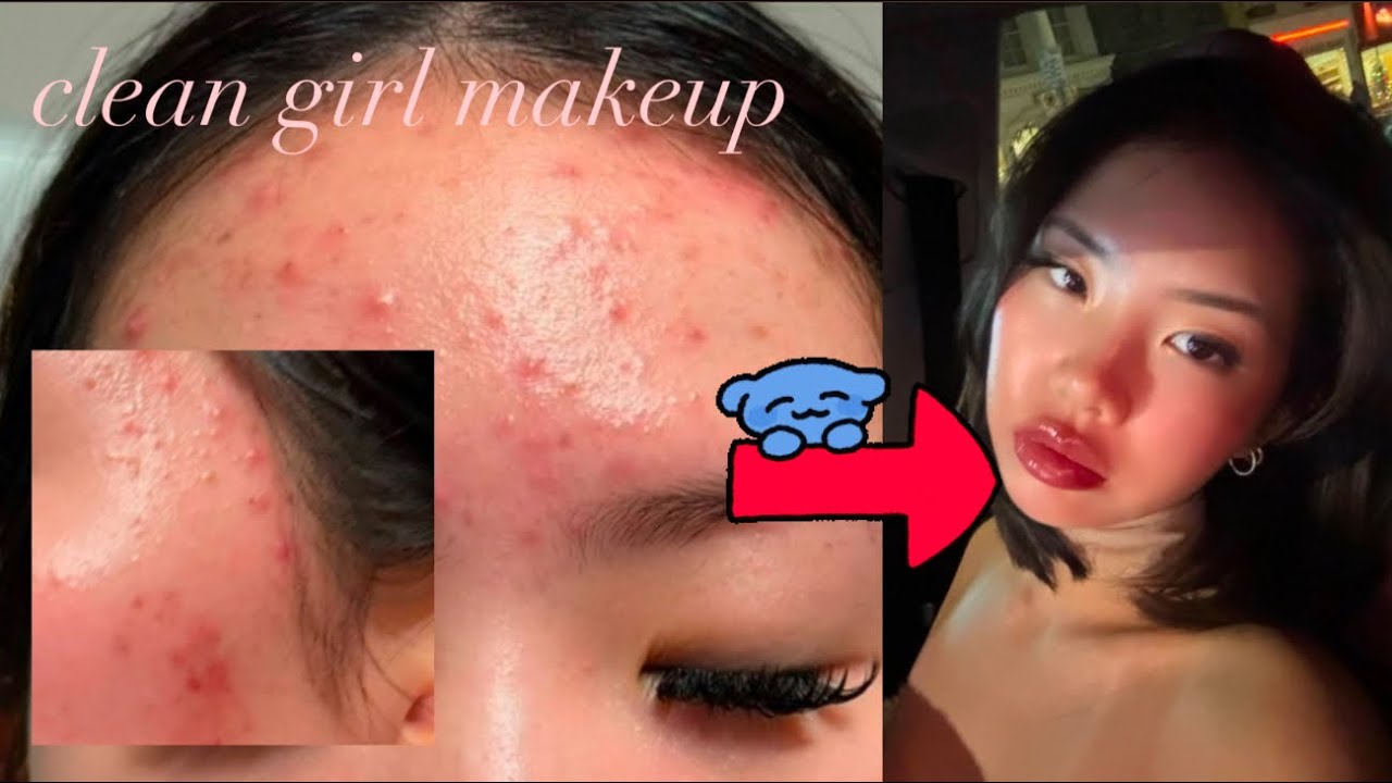 How to do Clean Girl Makeup on acne prone skin - YouTube