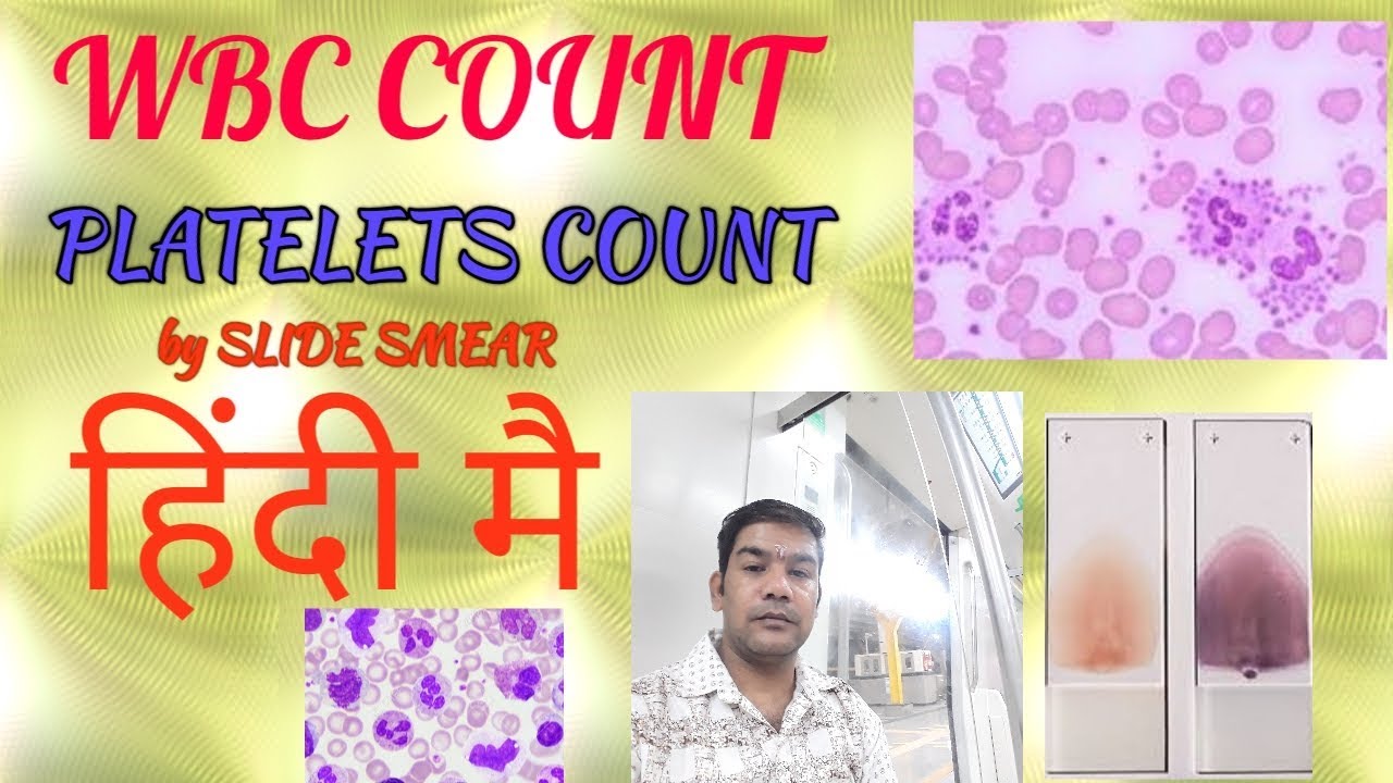 Slide Platelet Count