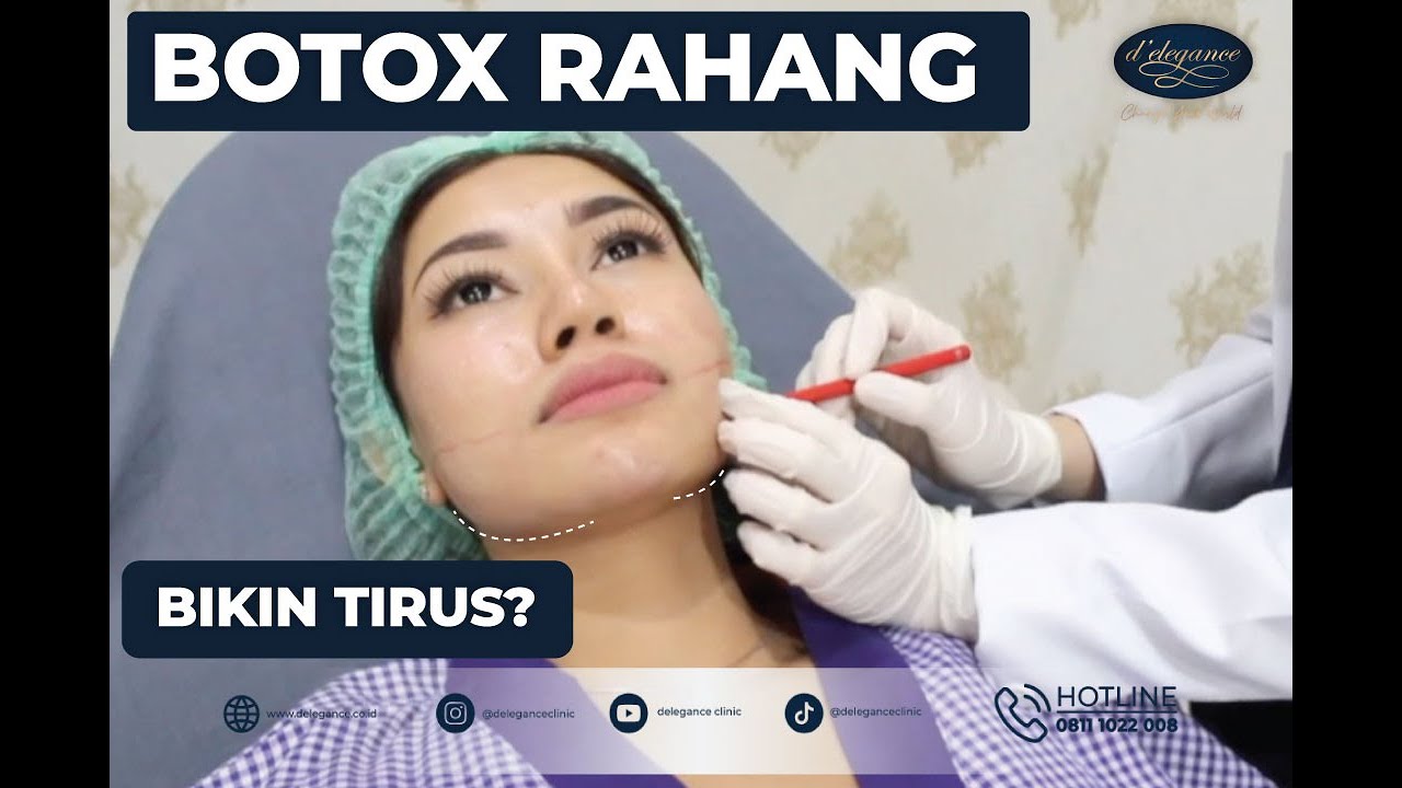 BOTOX RAHANG BIKIN WAJAH KAMU TIRUS !! - YouTube