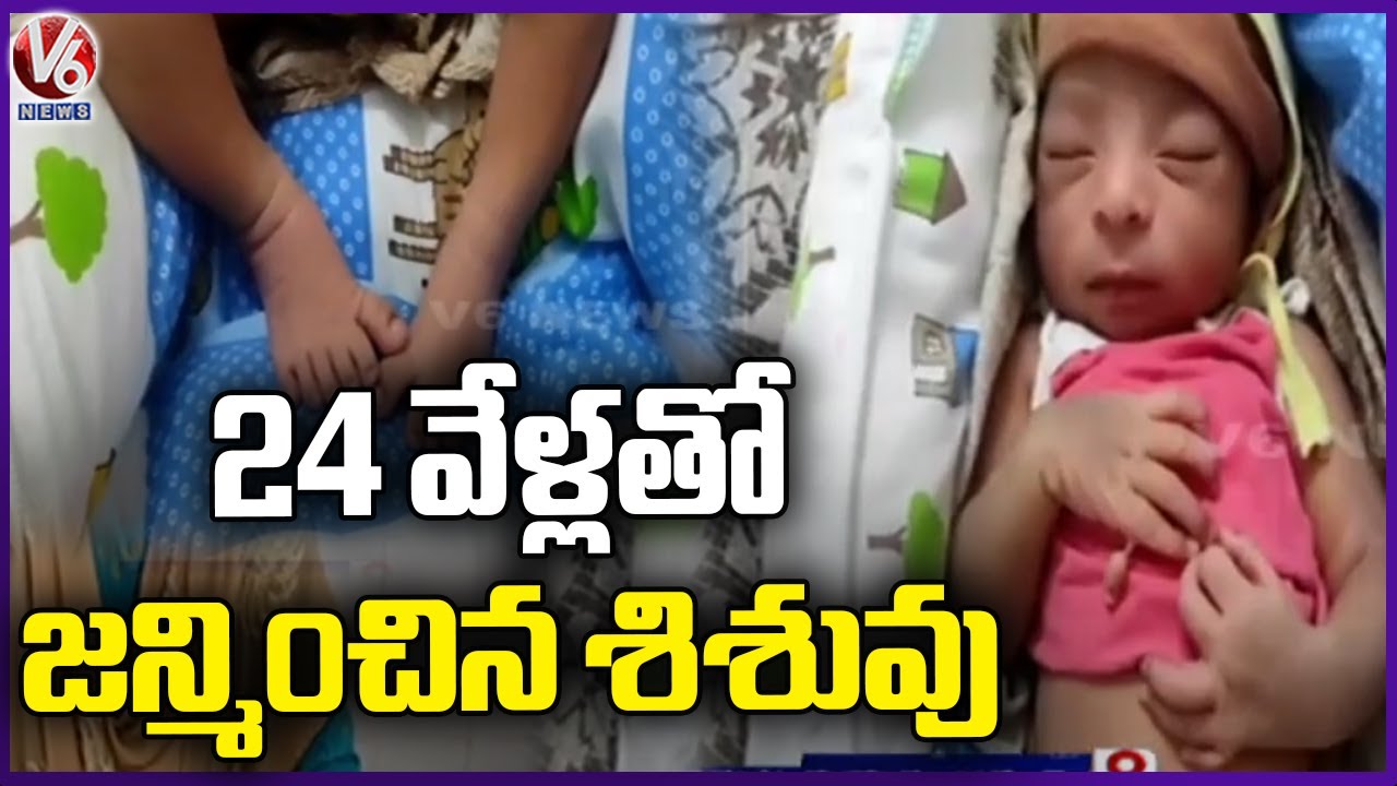 Child Born With 24 Fingers At Korutla Govt Hospital | Jagital | V6 News ...