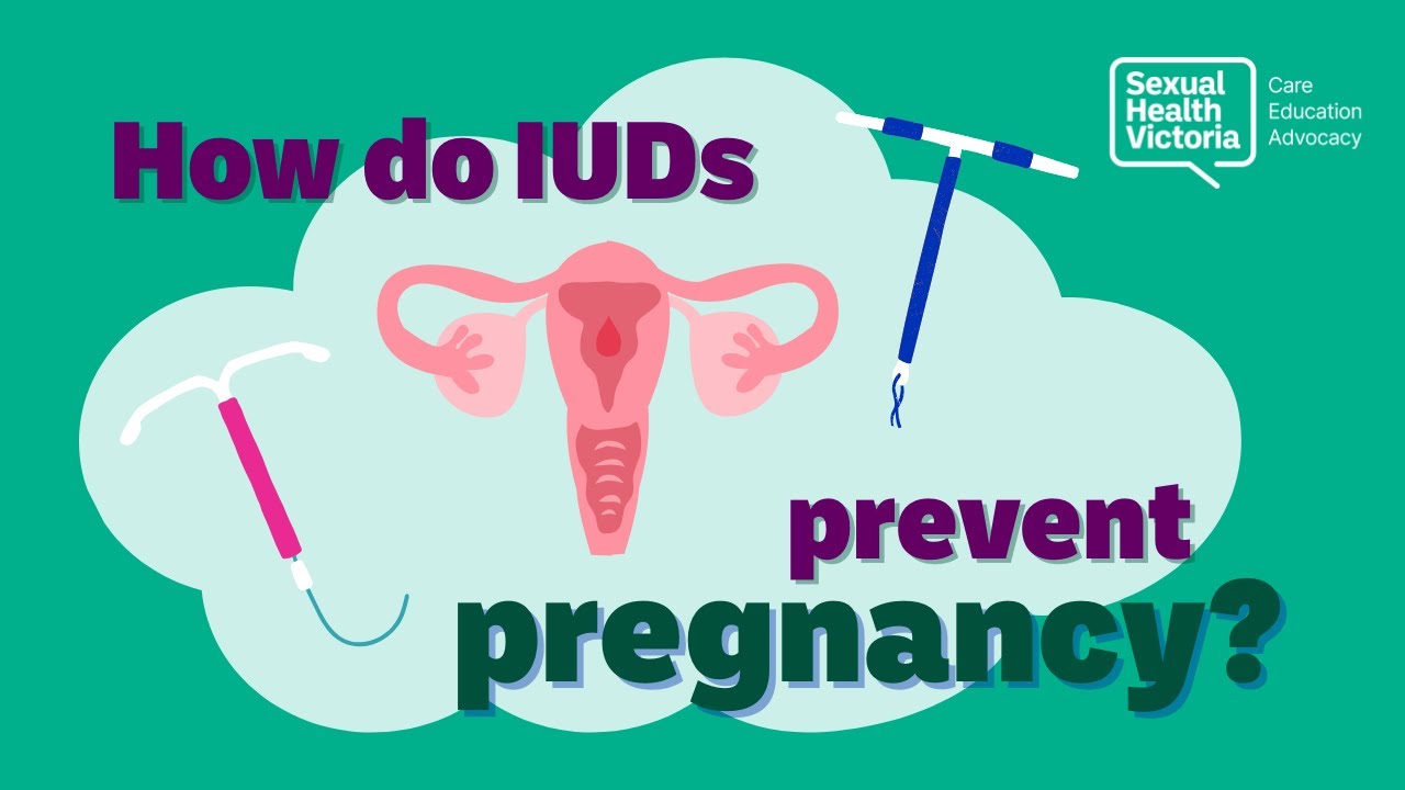 How do IUDs work? - YouTube
