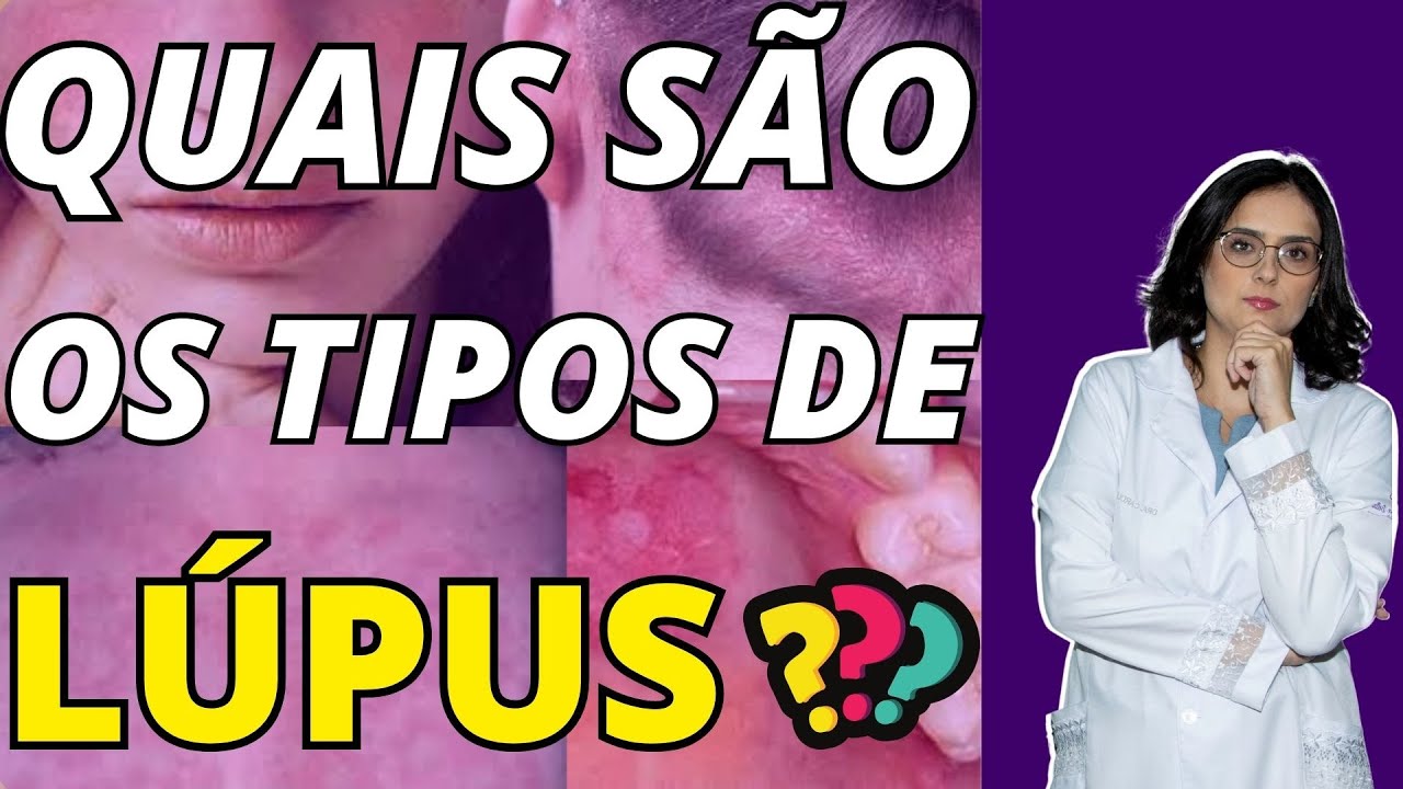 Tipos de lúpus I Quais são os tipos de lúpus? I Leo&carol Ensina - YouTube