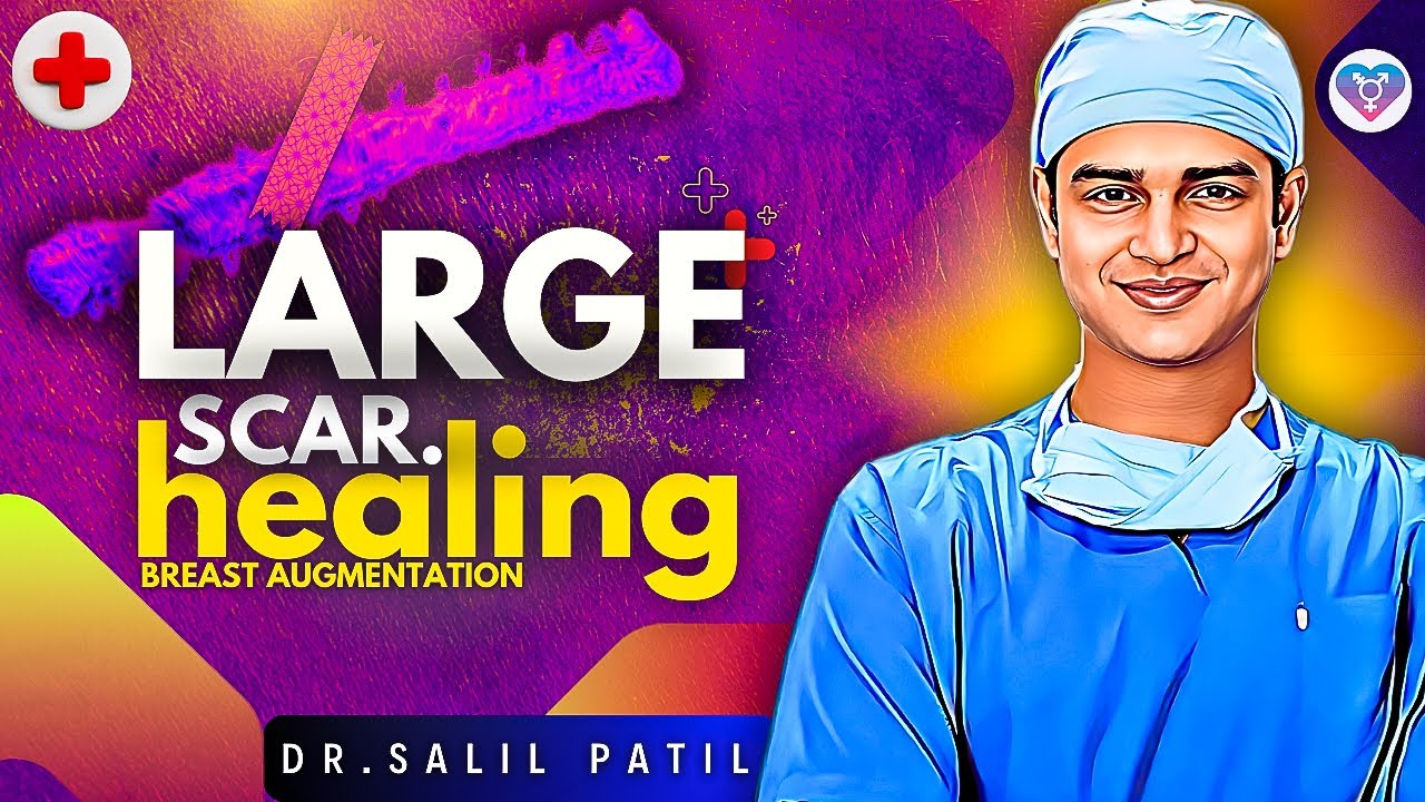 Scar revision treatments | Decision making | Planning Timeline - YouTube