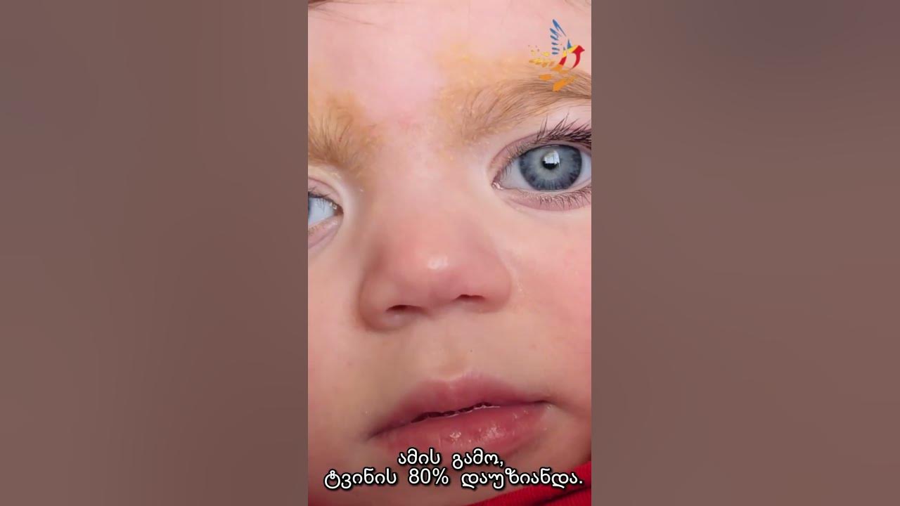๐โแแฅแแแแ แจแแแแ แแแ แแแแชแแแแโ Youtube