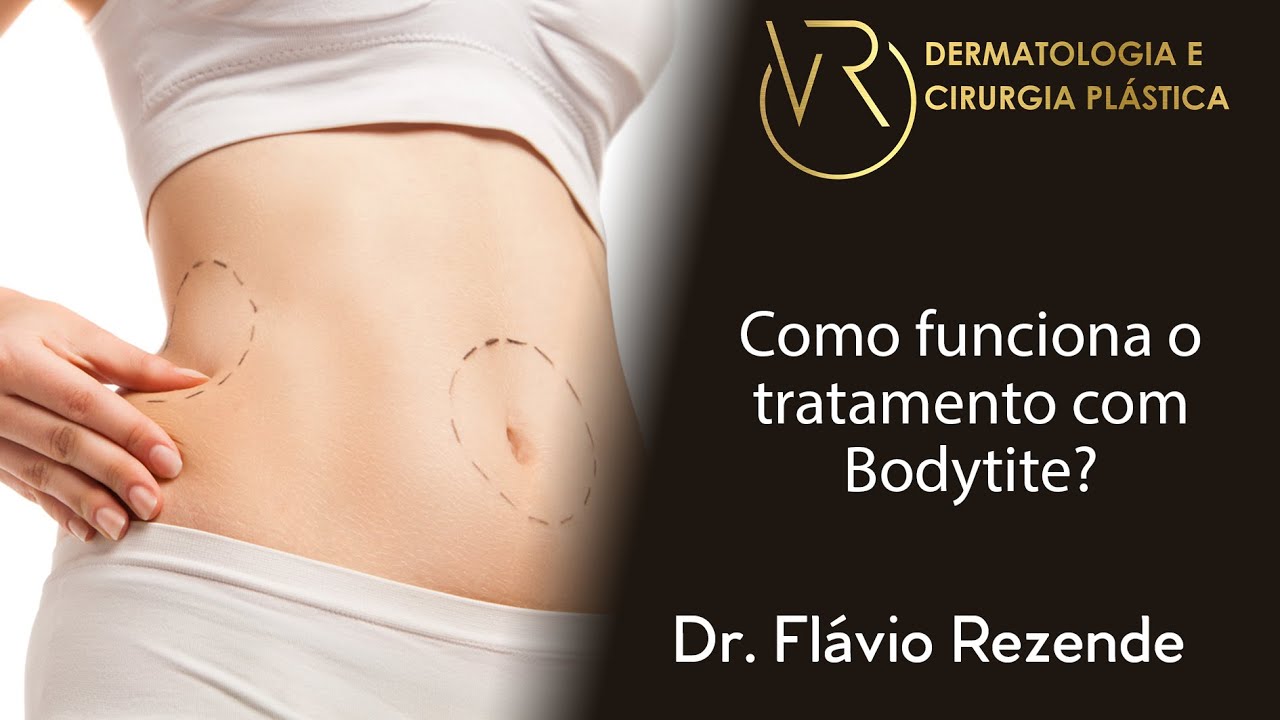 Como funciona o tratamento com Bodytite? Dr. Flávio Rezende - YouTube
