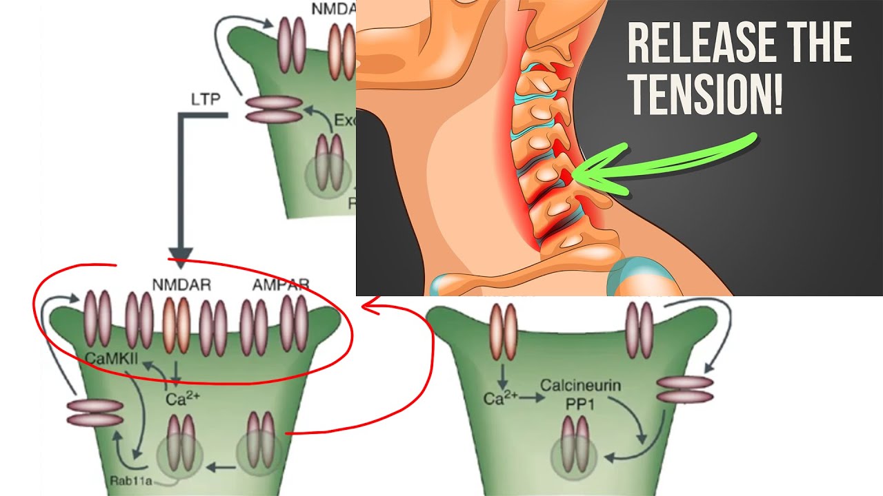 New Tinnitus Breakthrough! Somatosensory co-factors, LTD/LTP, Susan ...