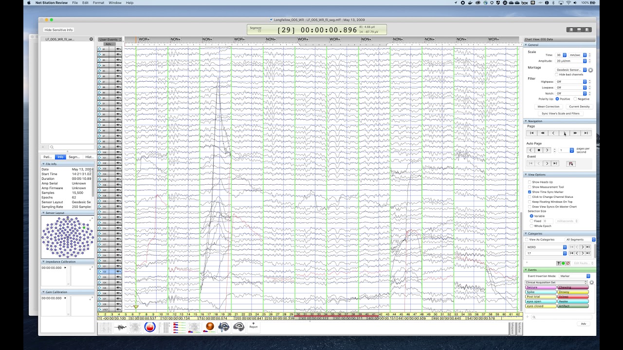 NIMH CMN Tutorial - EEG Single Subject Data Analysis in Net Station ...