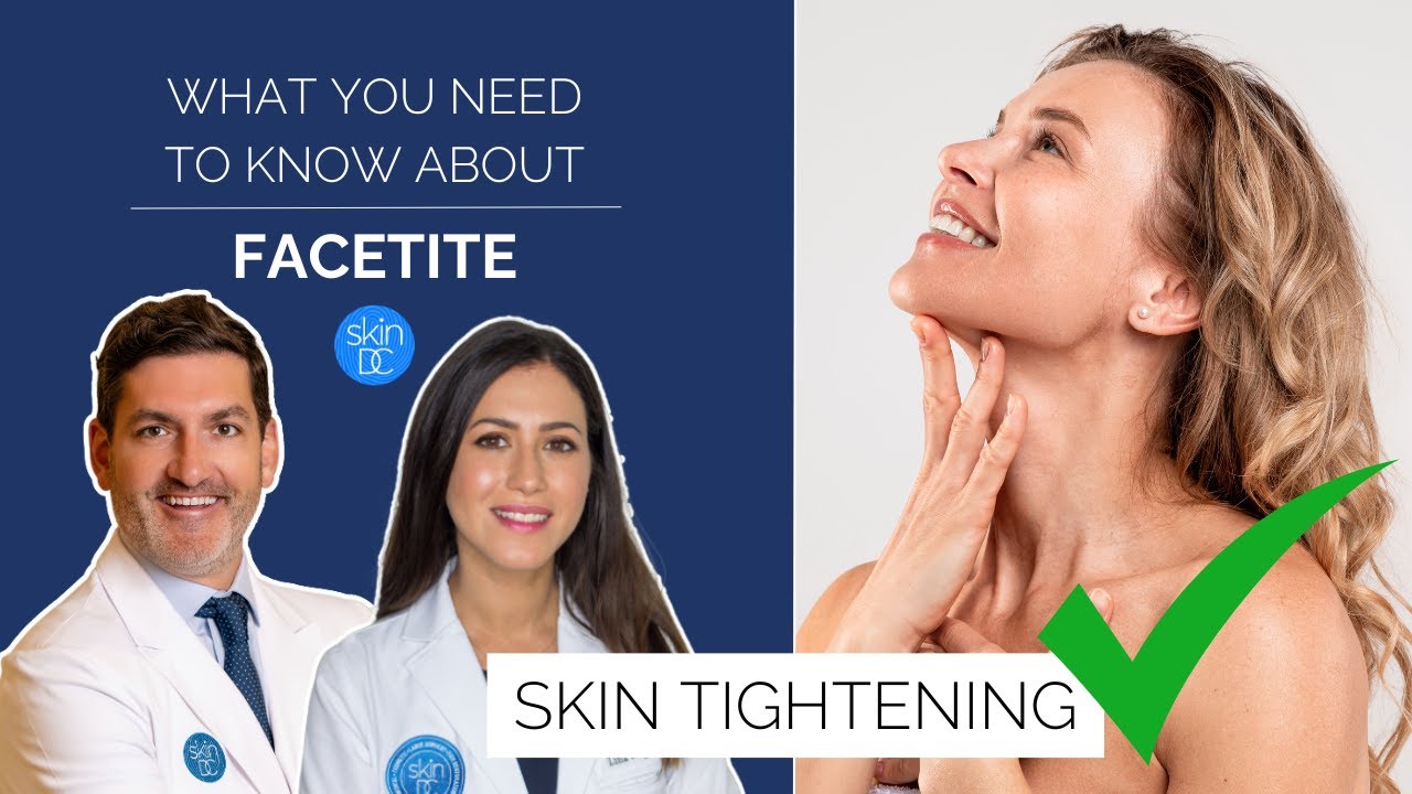 What is FaceTite and HOW does it work? - YouTube