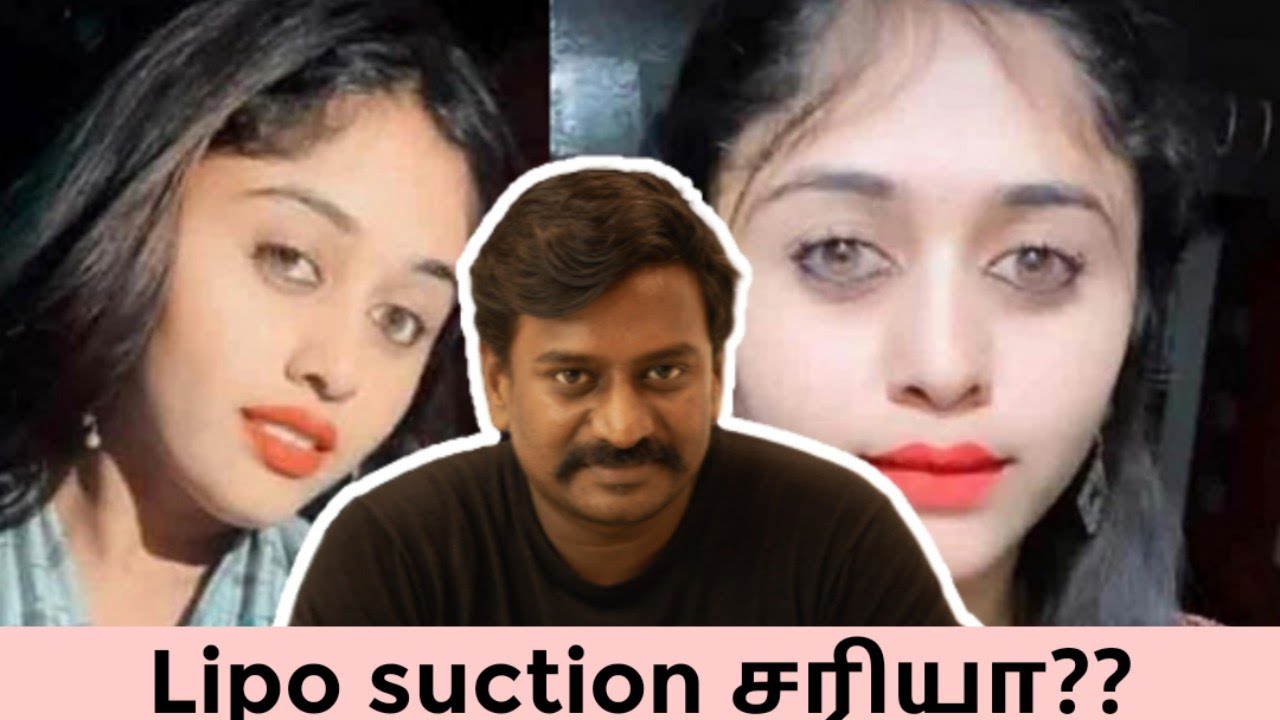 Actress Chethna Raj Story EXPLAINED | Cosmetic Procedures| Mysore ...