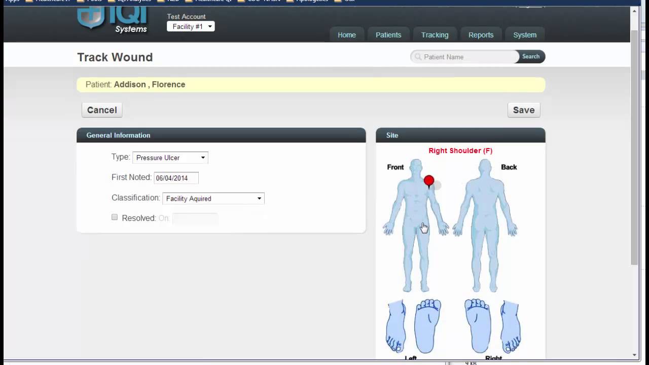 Wound Module Overview - YouTube