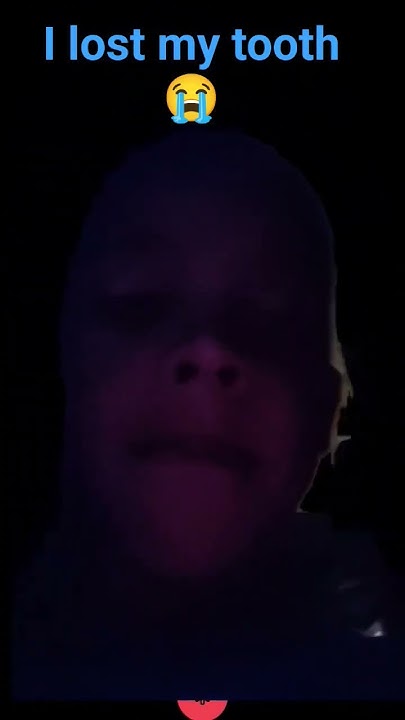I lost my tooth 😭😭😭 - YouTube