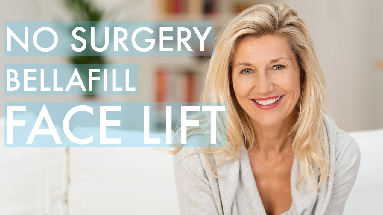 The Bellafill BellaLift Non-Surgical Face + Neck Lift - YouTube