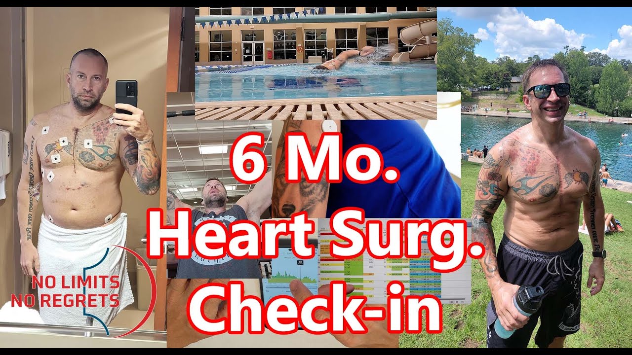 ROUGH 6 Months CARDIAC OP Surgery RECOVERY Home - OPEN HEART Surgery ...