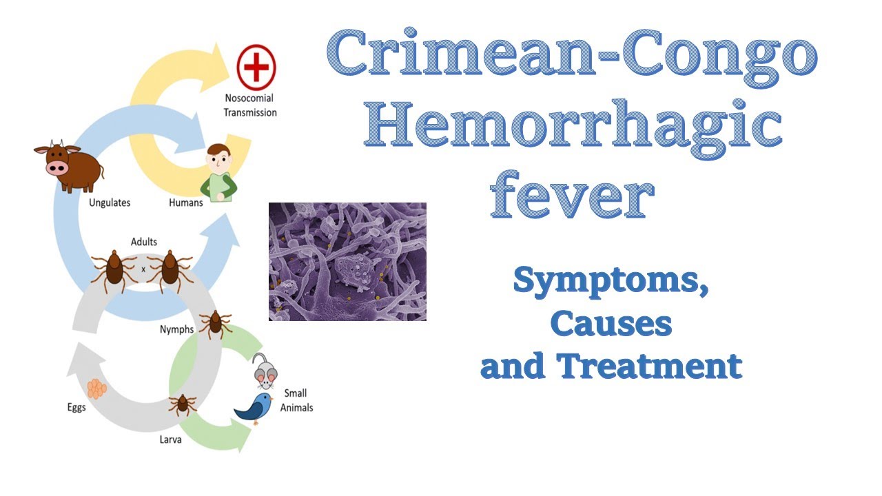 Crimean-Congo Hemorrhagic fever - Symptoms, Causes and Treament - YouTube
