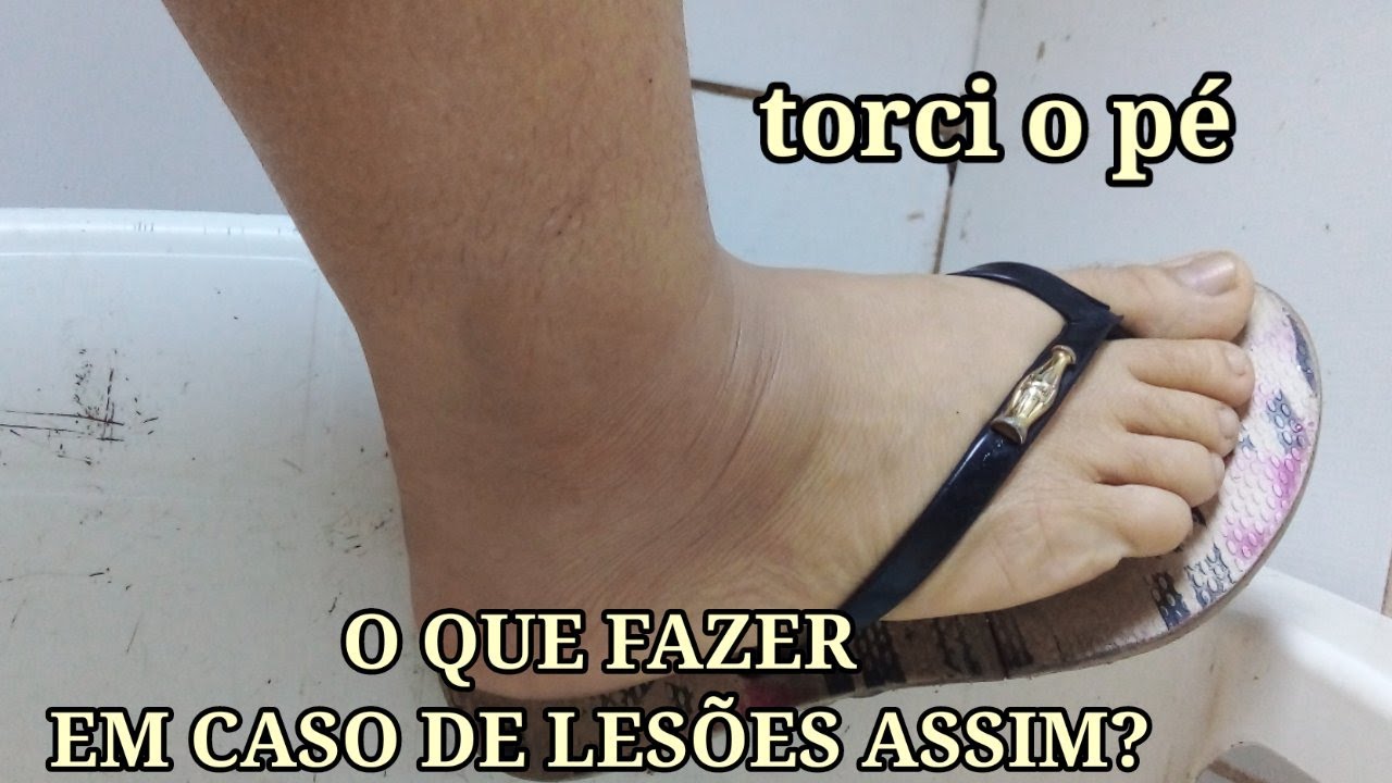Torci o pé ☹️ - YouTube