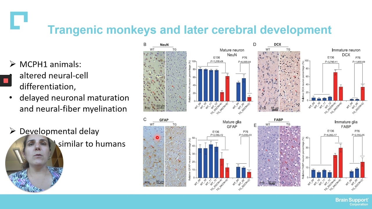 Transgenic monkeys expressing a human gene generated human like brain ...