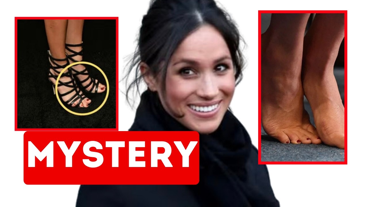 Meghan Markle’s ‘ALIEN’ TOE Has the Royal Family Worried! - YouTube