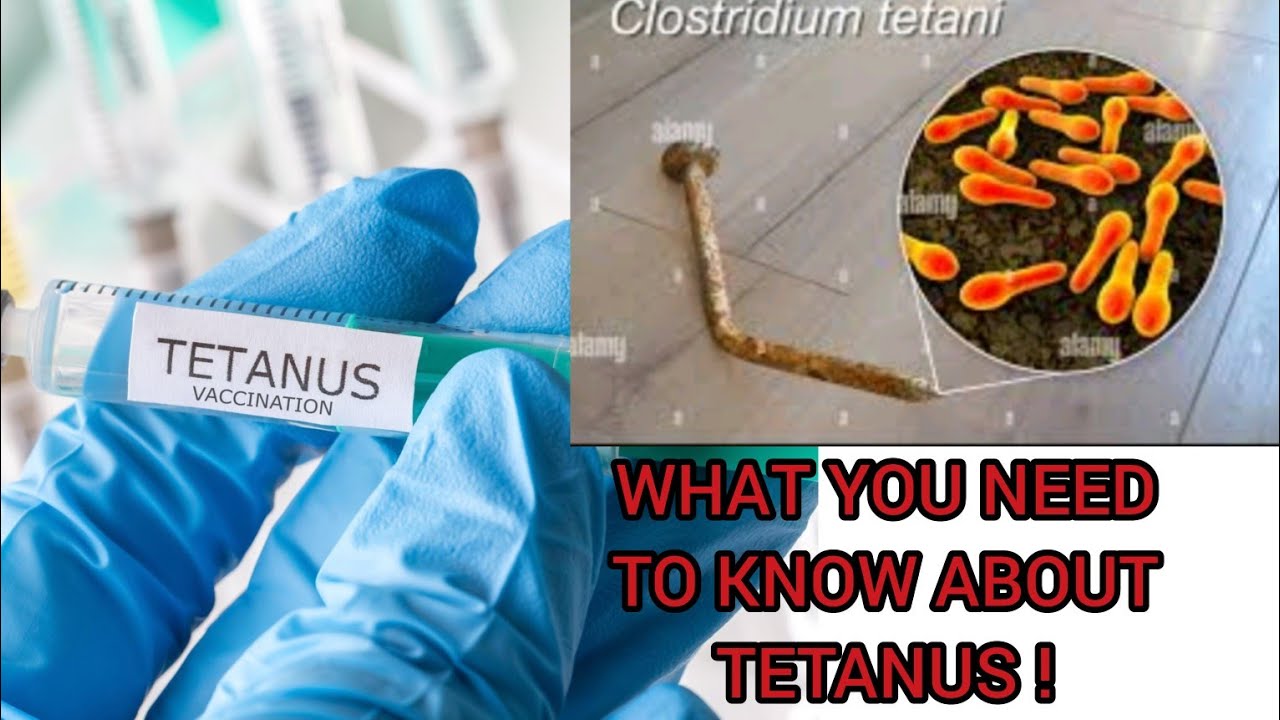 What Is Tetanus | Signs And Symptoms - YouTube