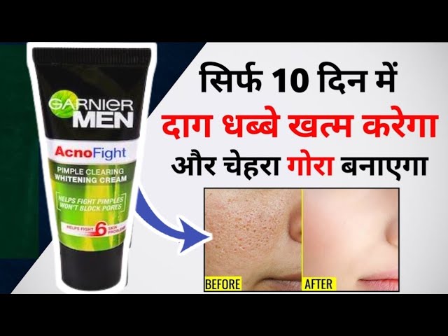 Garnier Men Cream