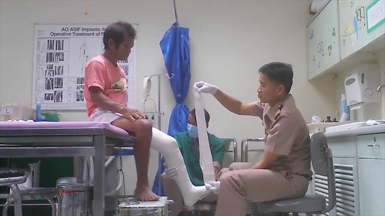 Application long leg cast by RAKE Krittanai - YouTube