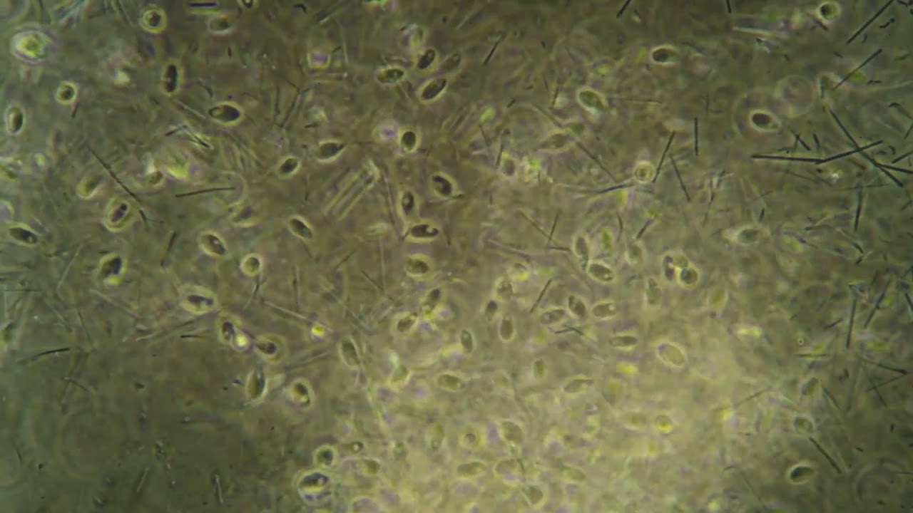 Microbial Decomposition 1 - YouTube