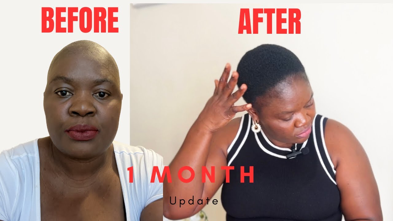 ONE MONTH HAIR UPDATE AFTER SHAVING MY HEAD BALD. ️🫶 #baldhead #bigchop ...