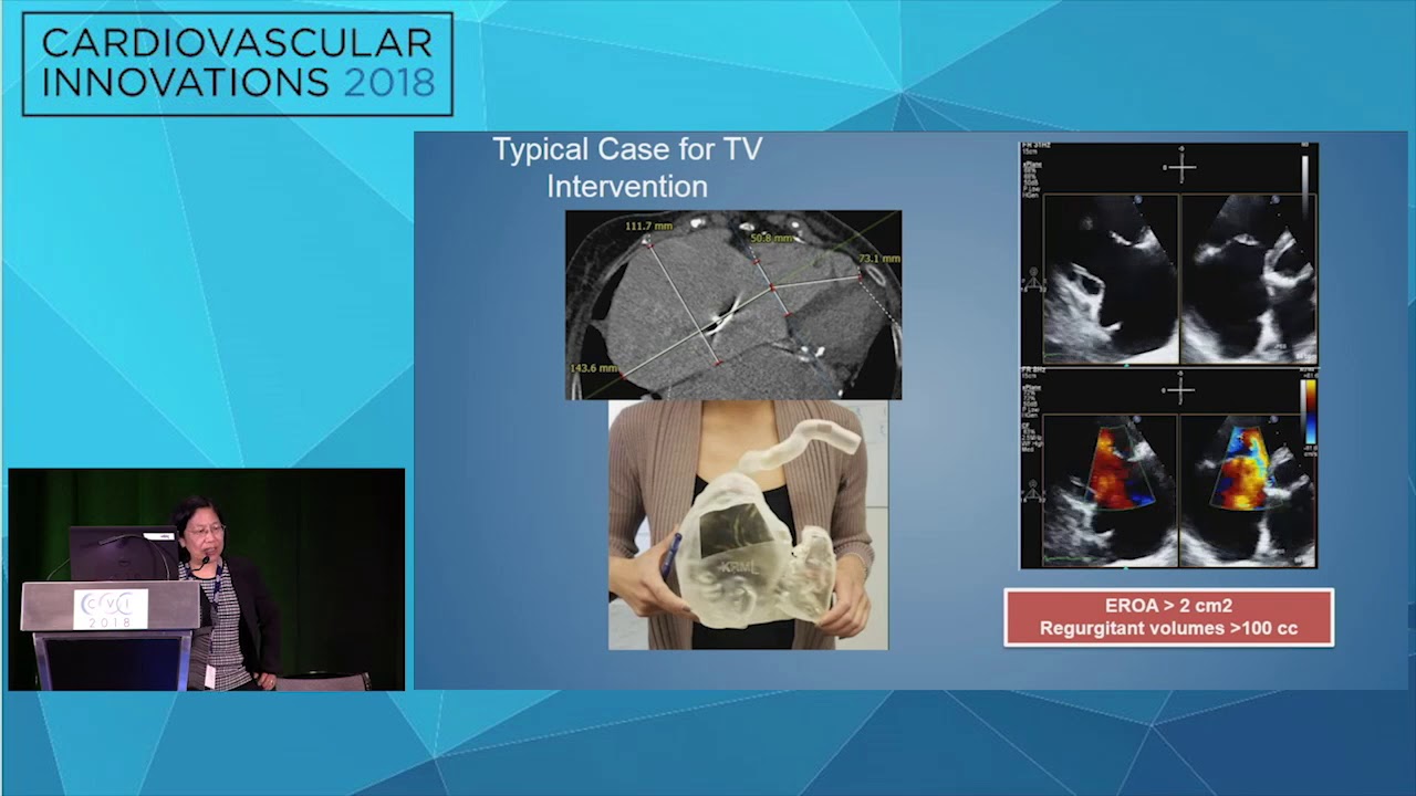 CVI2018 Session: What are the clinical endpoints for TR? - Rebecca Hahn ...