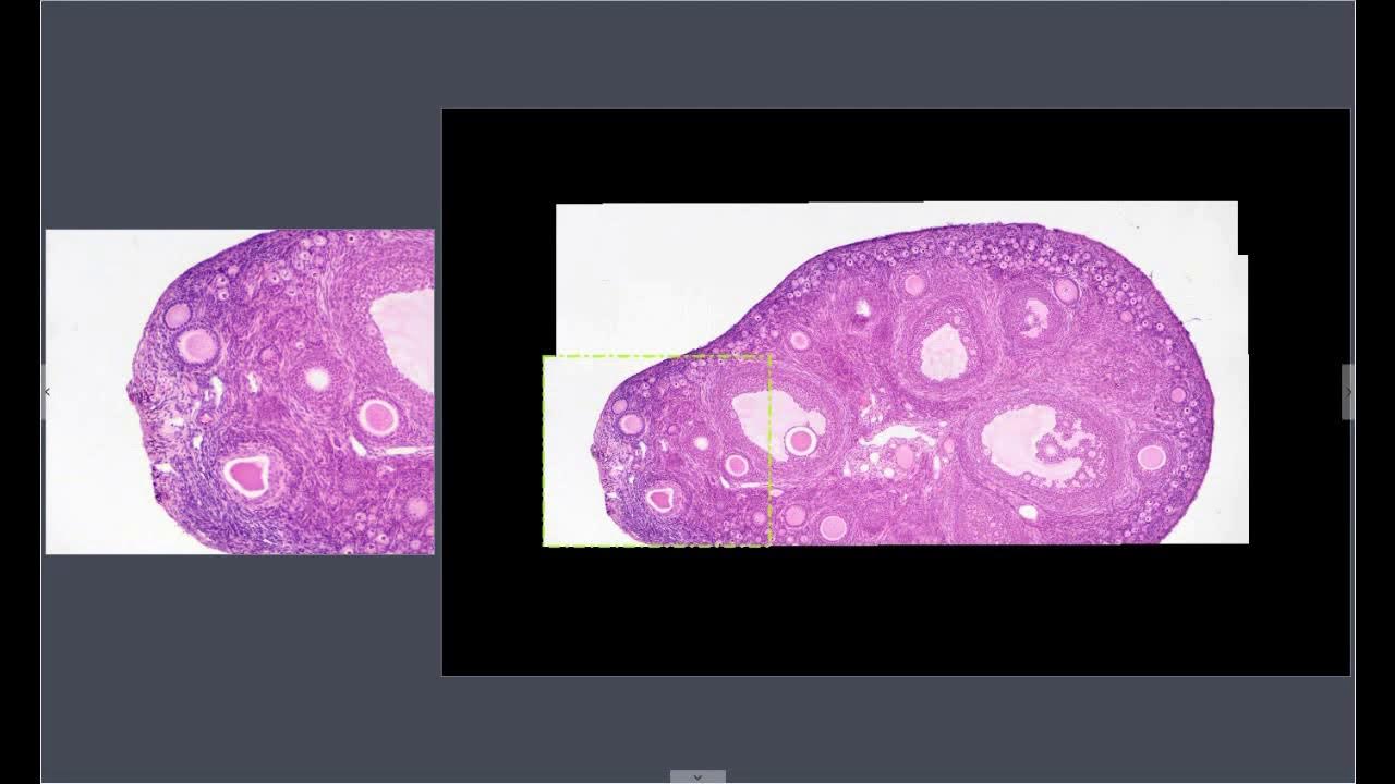 Live Stitching of images, by BioStitch-500 to convert a microscope to a ...