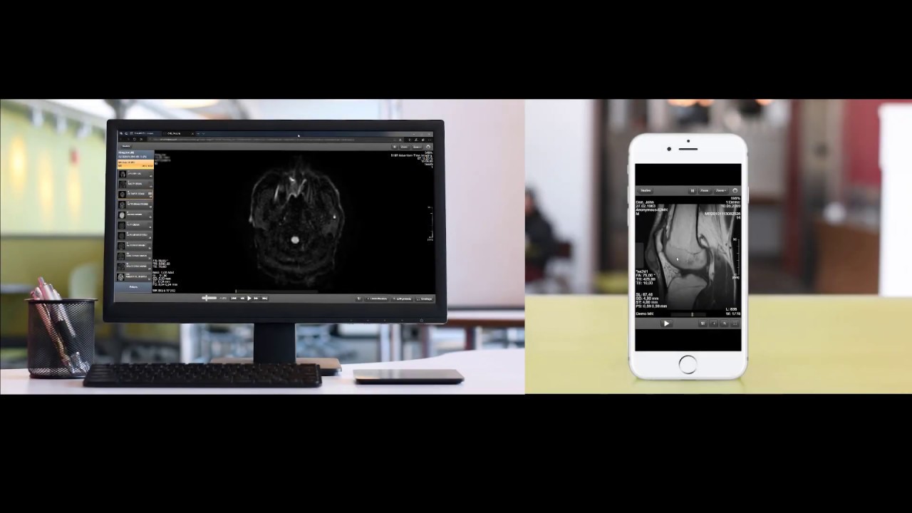 OmniPACS Introduction: The Basic Viewer - YouTube