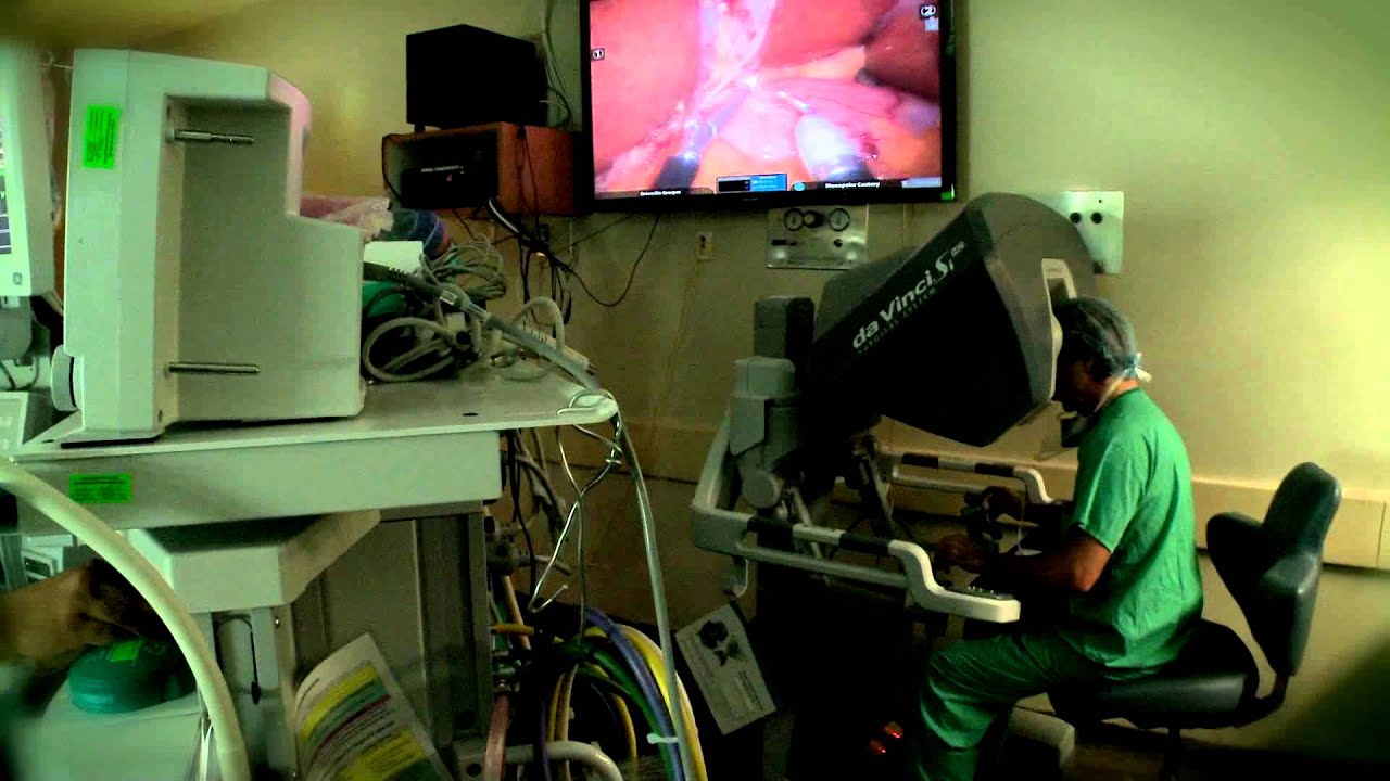Single Site da Vinci Surgery - Gall Bladder - YouTube