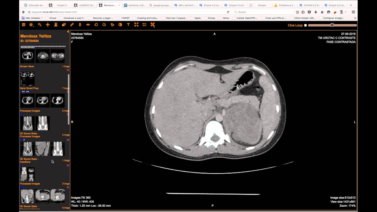 oviyam-2.2 - YouTube