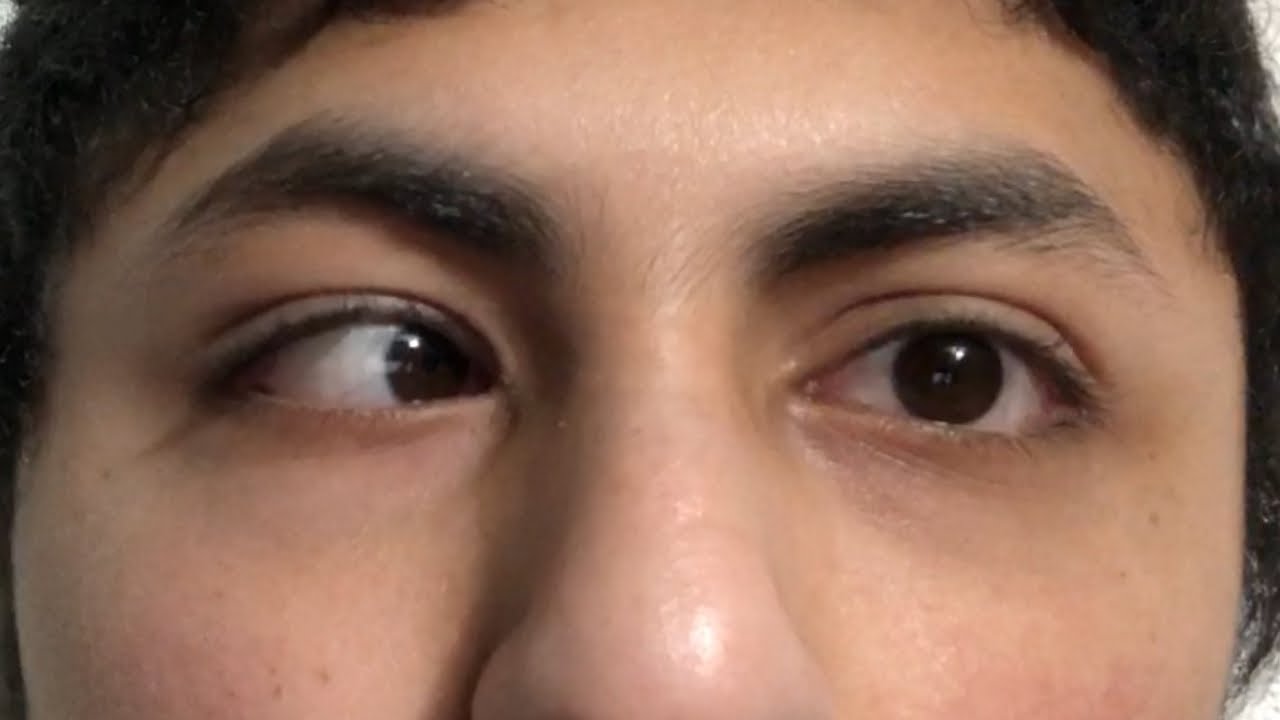 Learning To MOVE ONE EYE - YouTube