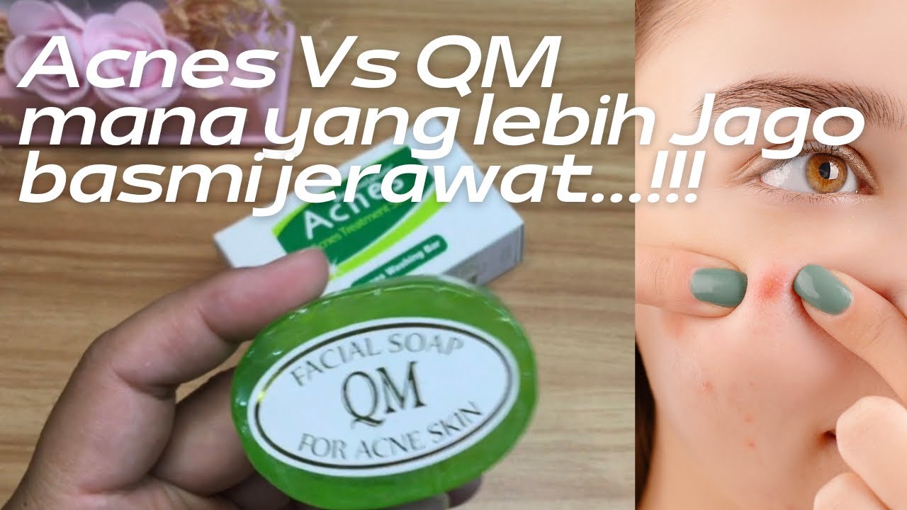 REVIEW SABUN JERAWAT PUNGGUNG DAN WAJAH QM & ACNES - YouTube