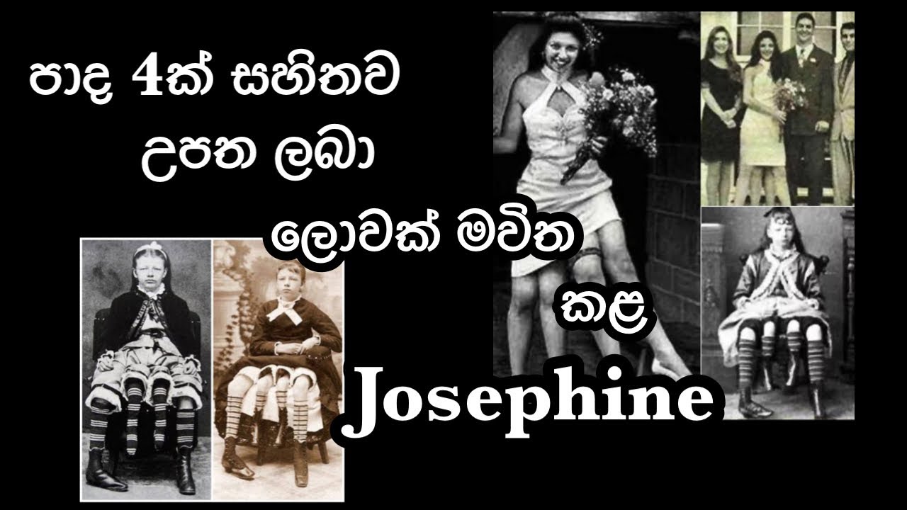 |A Girl With Four Legs|Josephine Myrtle Corbin| - YouTube