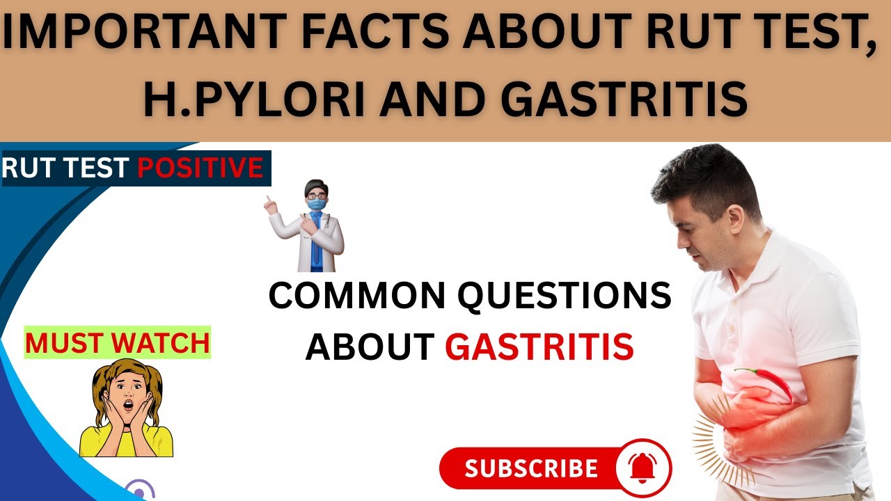 MUST KNOW ABOUT GASTRITIS, H. PYLORI, RUT TEST POSITIVE - YouTube